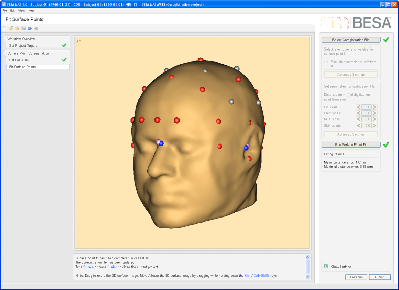 BESA MRI Software | Symbiotic Devices
