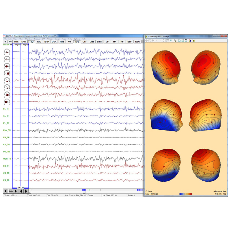 Products by Name | Symbiotic Devices