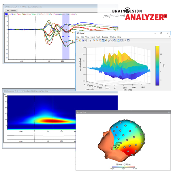 BrainVision Analyzer 2 | Symbiotic Devices